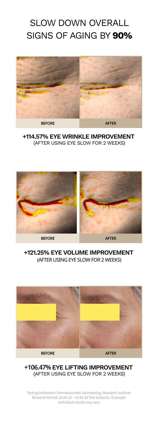 EYE SLOW Oil Roller – House of Balance